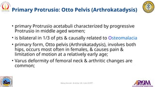 Protrusio Acetabuli -Acetabular protrusion - Otto pelvisi.pptx