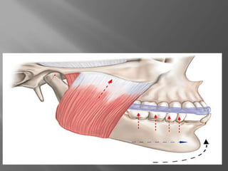 Protrusive mandibular movements | PPTX
