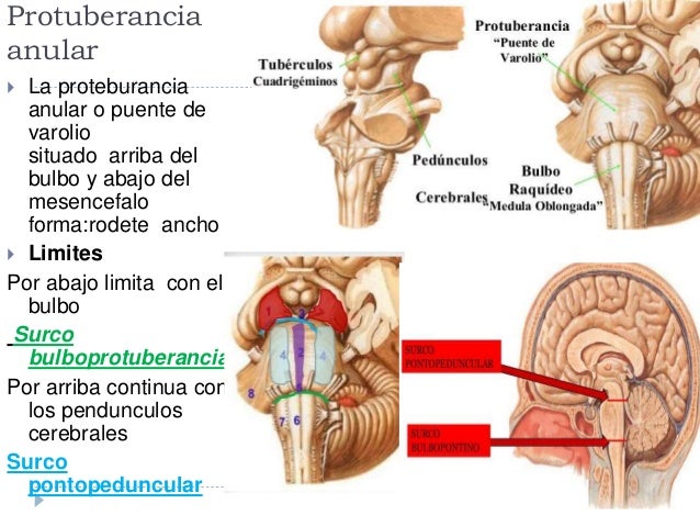 Protuberancia anular