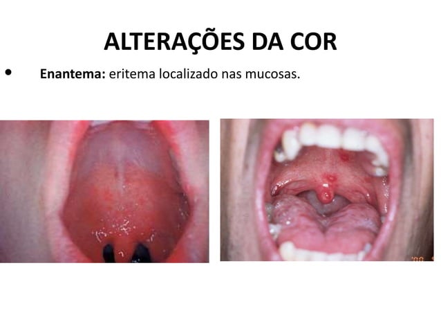Prova 1 - dermatologia (lesões elementares, semiologia, exames e sinais ...