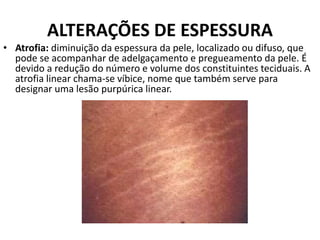 Prova 1 - dermatologia (lesões elementares, semiologia, exames e sinais ...