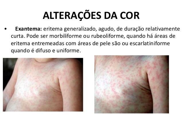 Prova 1 - dermatologia (lesões elementares, semiologia, exames e sina…