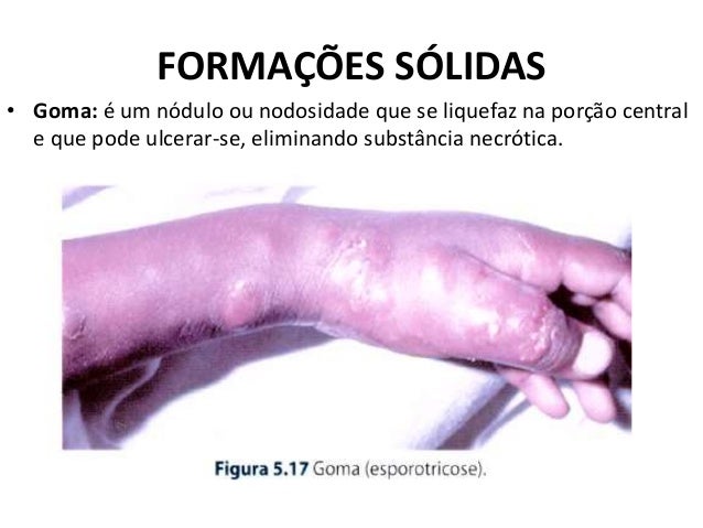 Prova 1 - dermatologia (lesões elementares, semiologia, exames e sina…