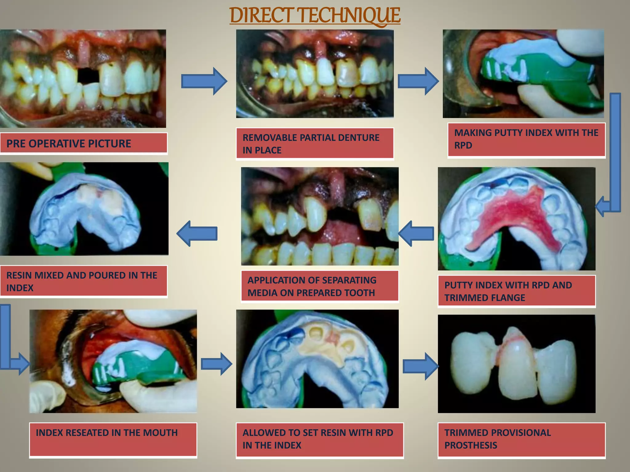 Provisional restoration | PPTX