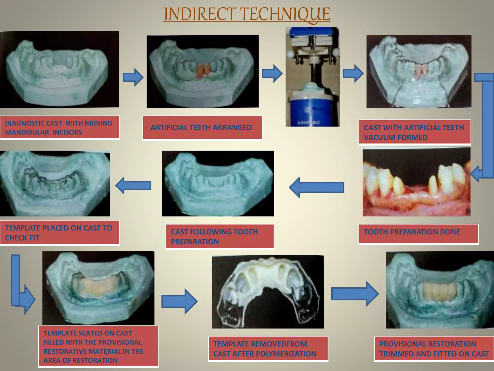 Provisional restoration | PPTX
