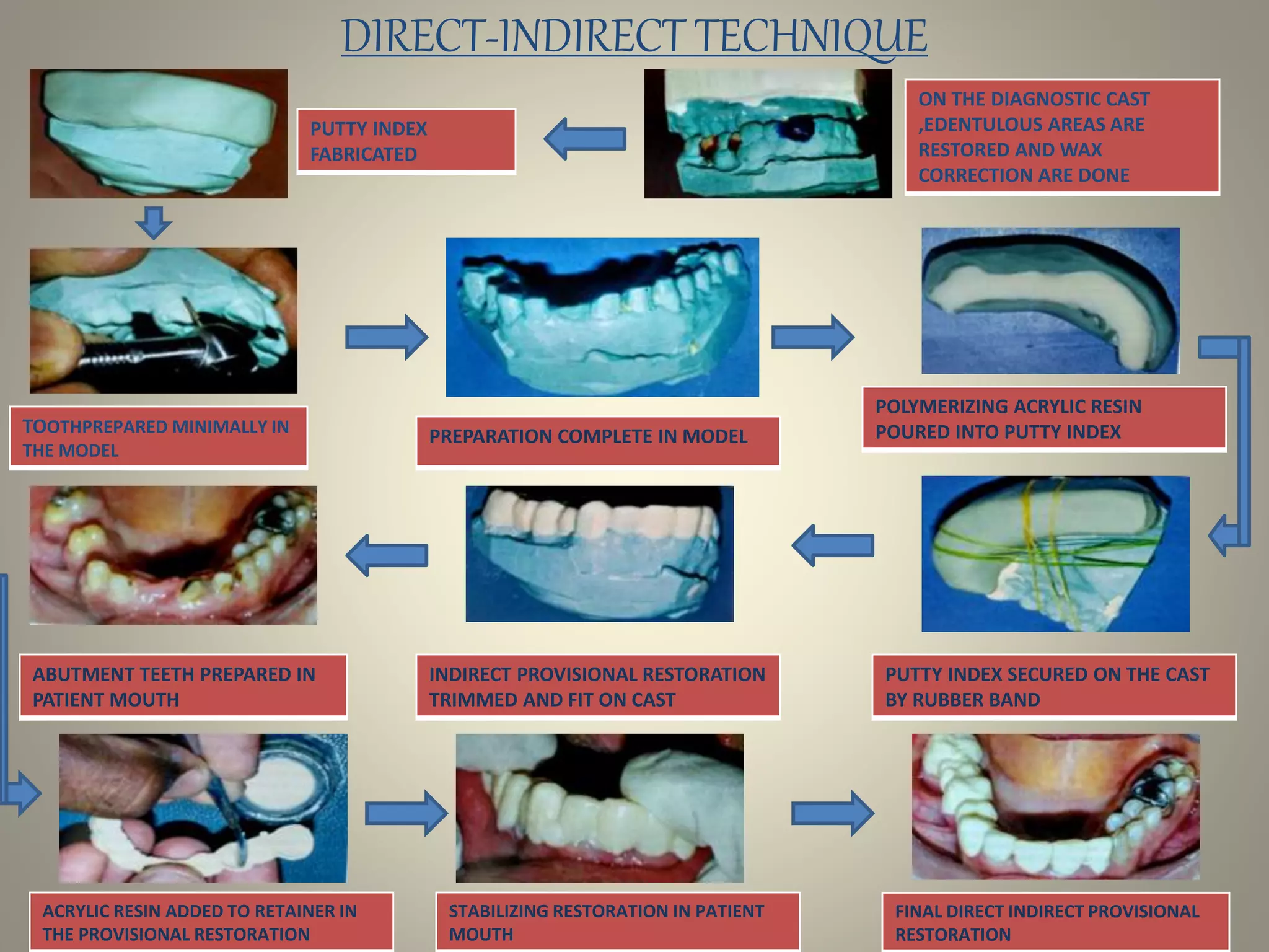 Provisional restoration | PPTX