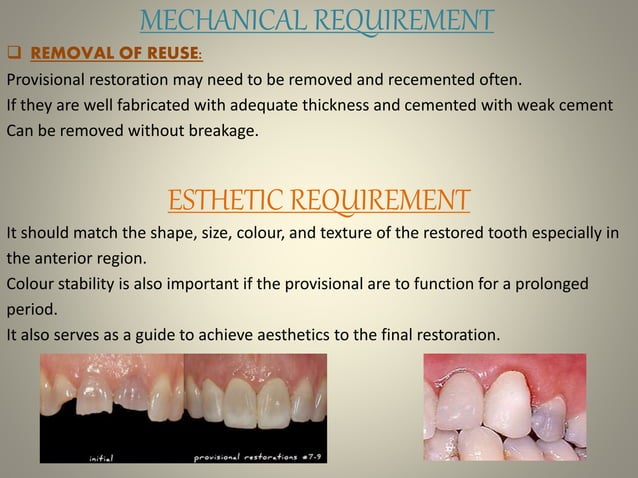 Provisional restoration | PPTX