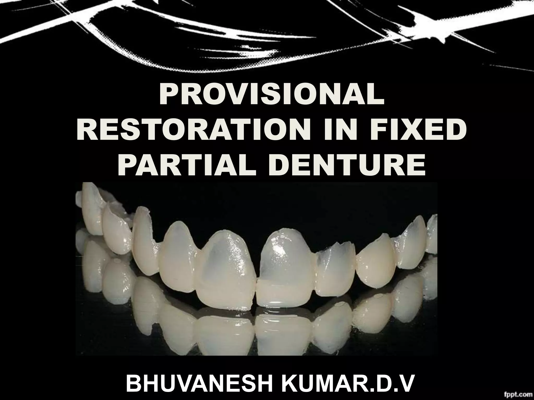 Provisional restoration in fixed partial denture | PPTX