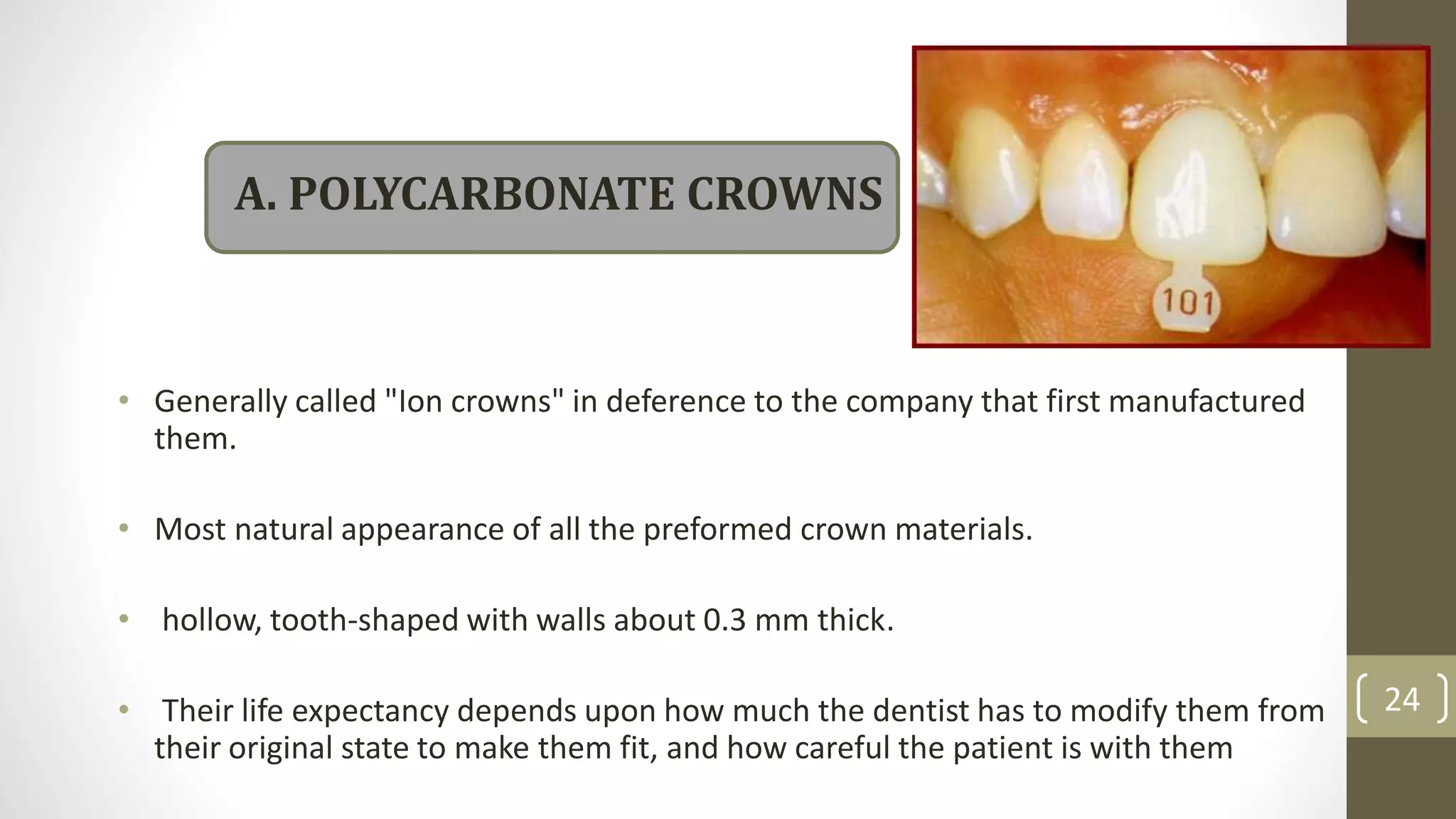 Provisional restorations in crowns and bridges | PPTX