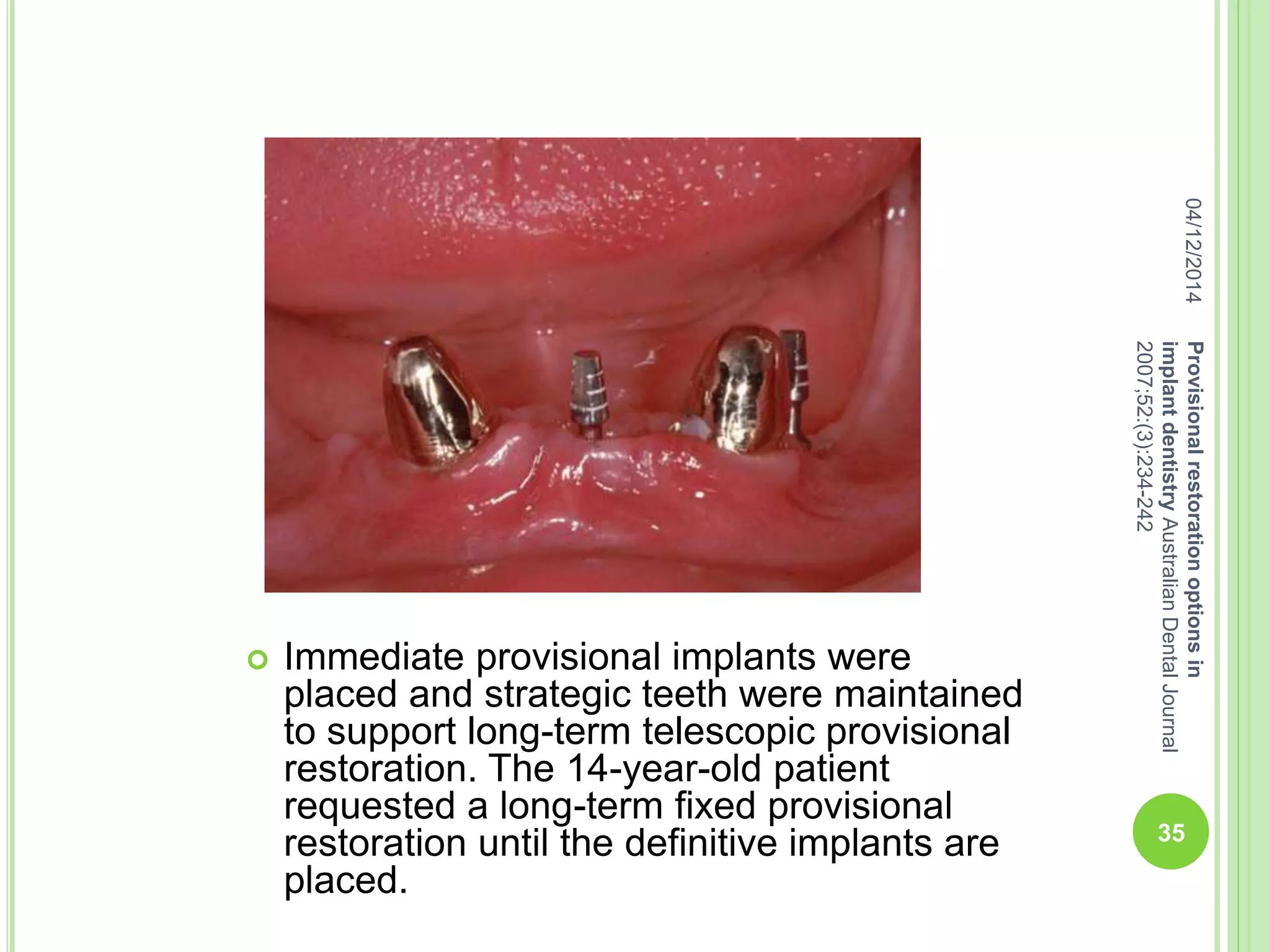 Provisional restorative options in implant | PPTX