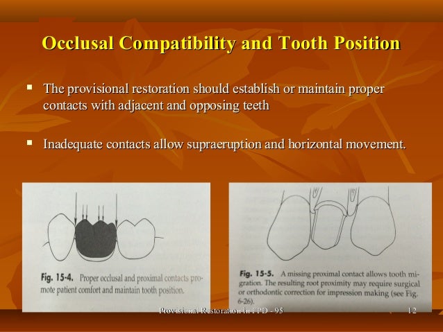 Provisonal Restoration