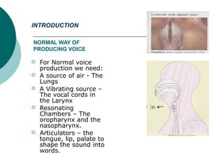Provox voice prosthesis implantation. | PPT
