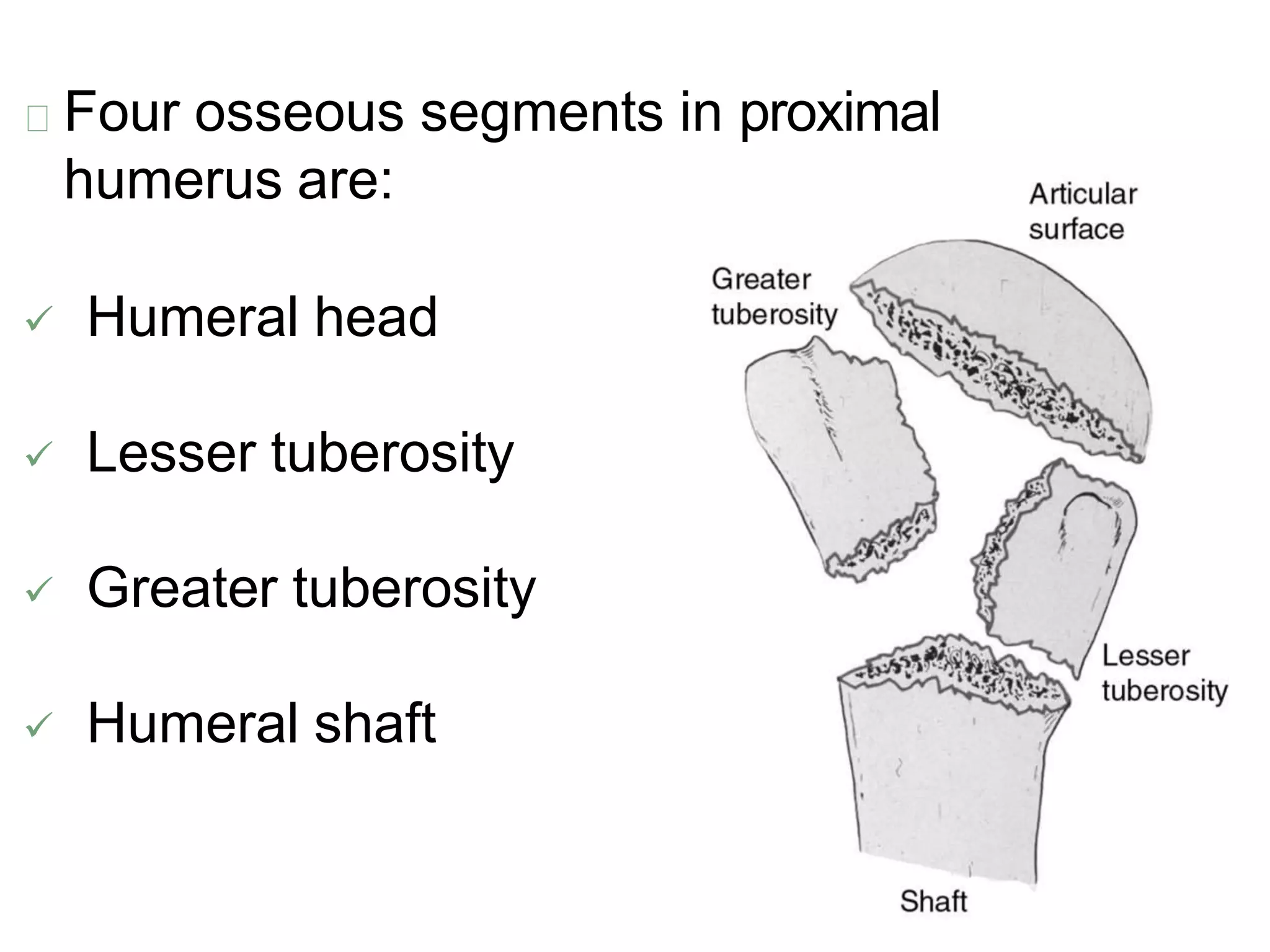 Proximal humerus fractures | PPTX