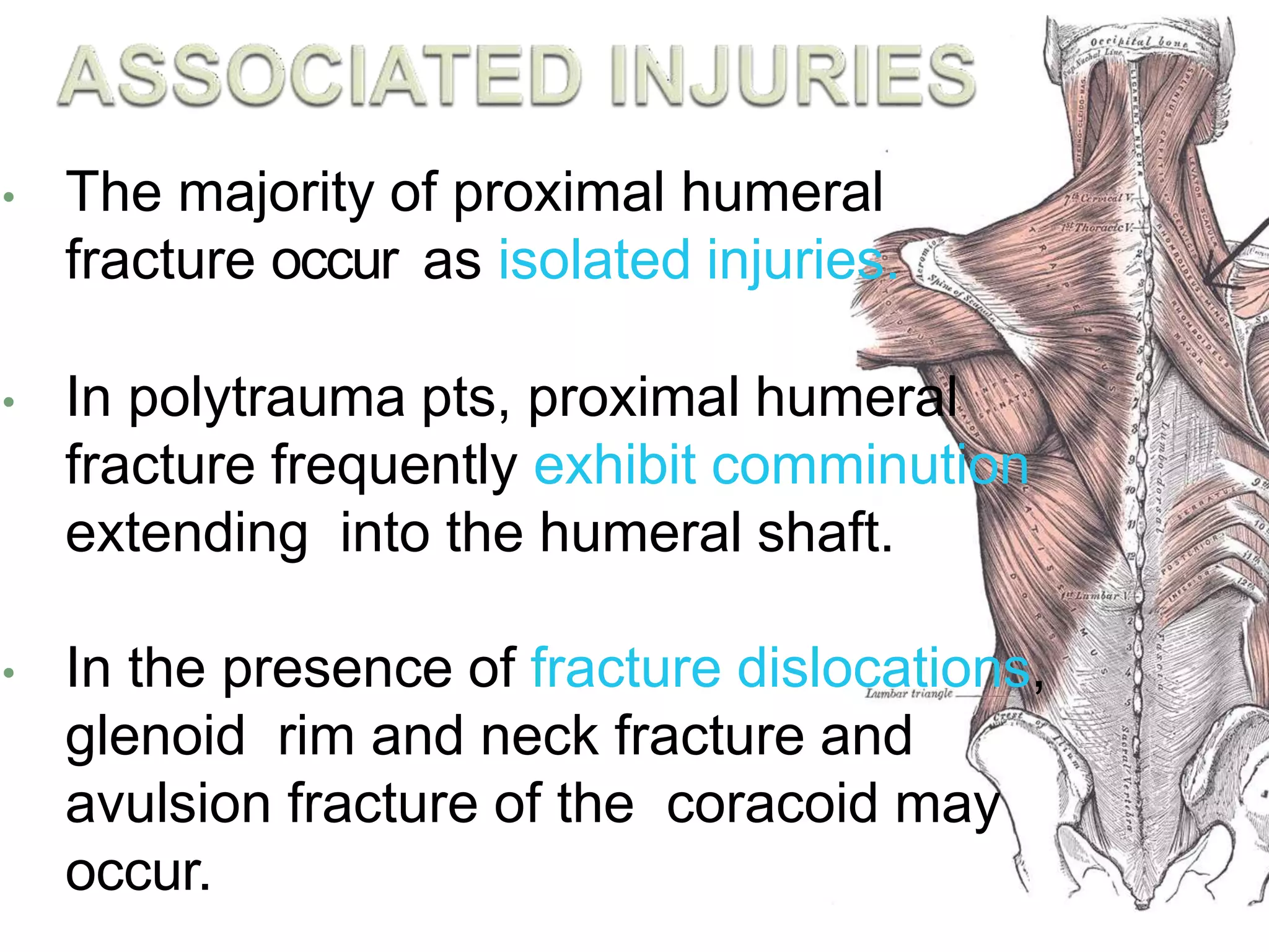 Proximal humerus fractures | PPTX