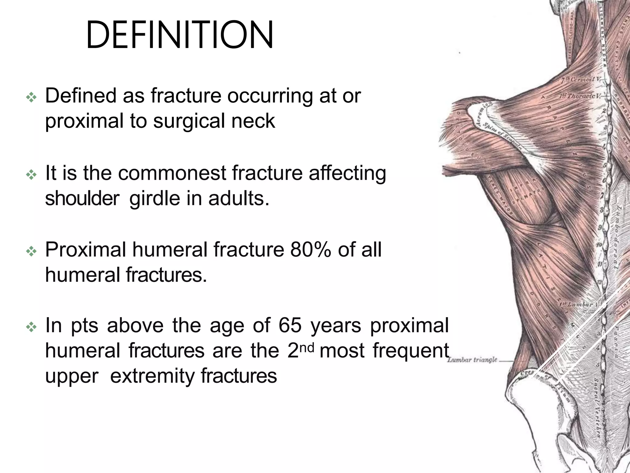 Proximal humerus fractures | PPTX