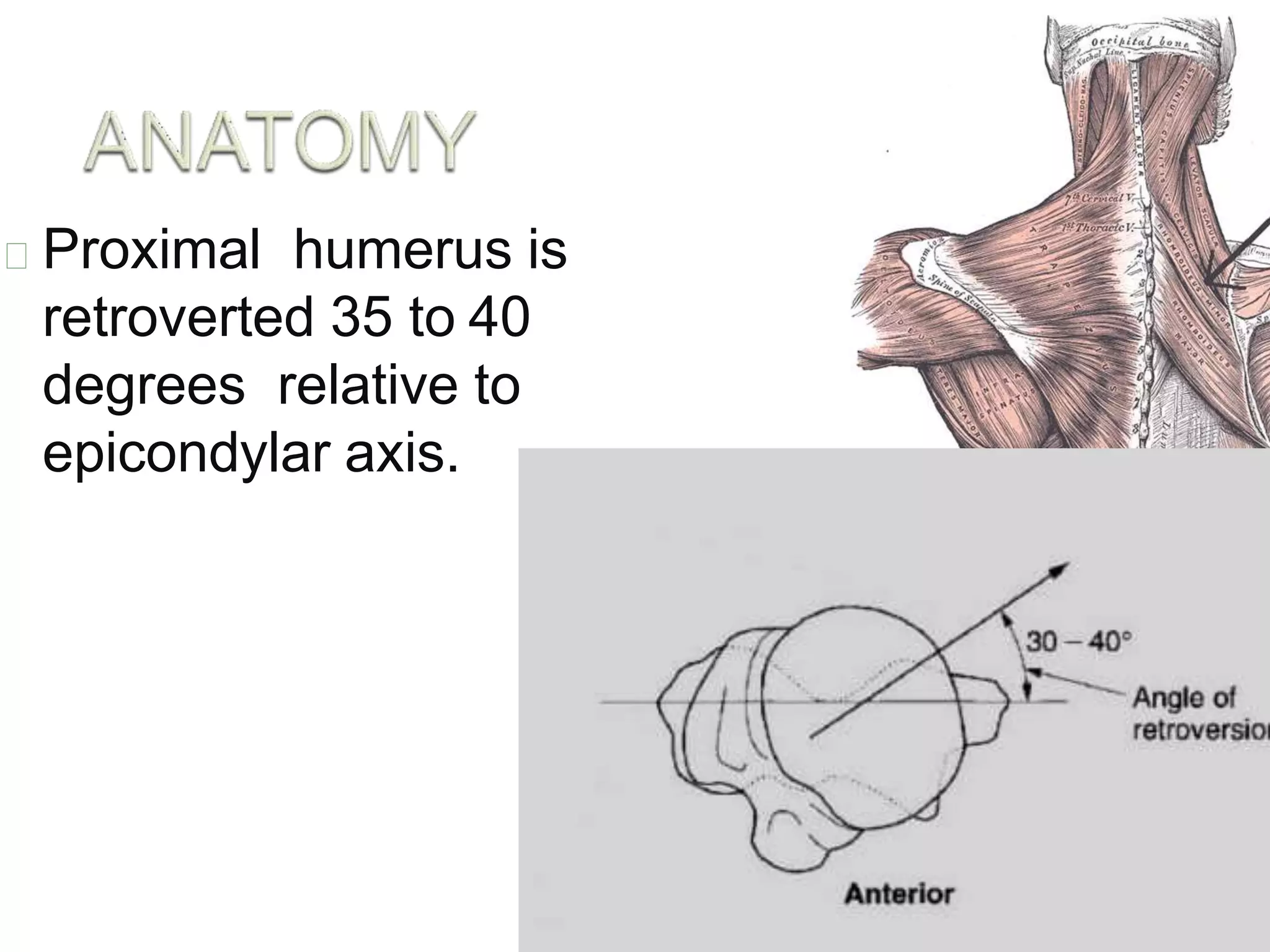 Proximal humerus fractures | PPTX