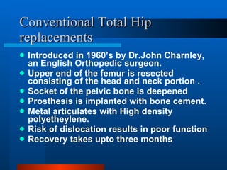 Proxima Hip Replacement | PPT