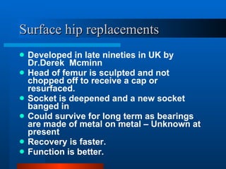 Proxima Hip Replacement | PPT