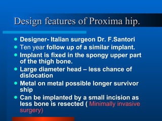 Proxima Hip Replacement | PPT