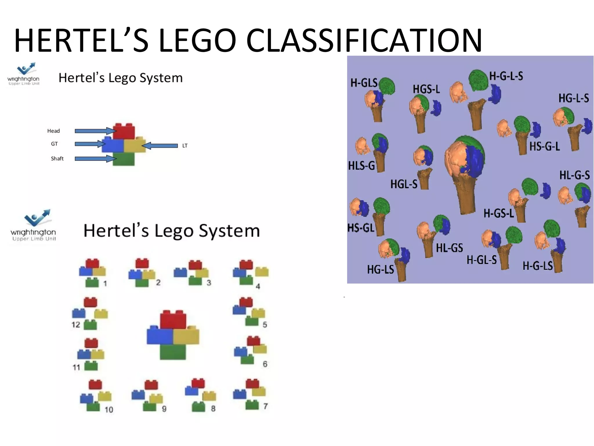 Proximal humerus-fractures | PPT