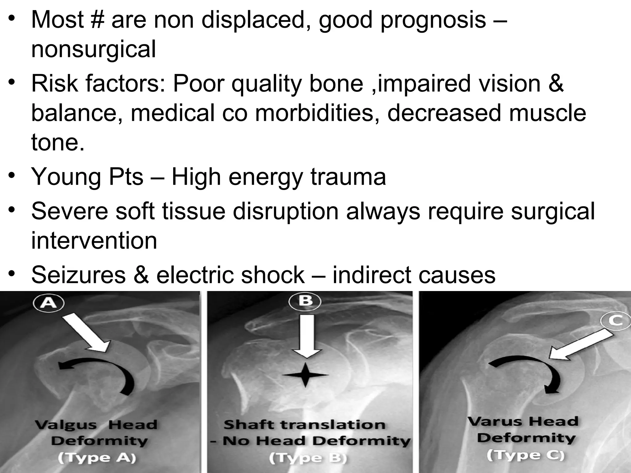 Proximal humerus-fractures | PPT