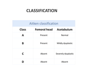 Proximal Femoral Focal Deficiency.pptx | Physical Therapy | Wellness
