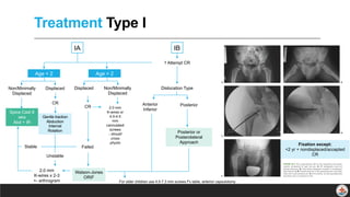 Proximal Femoral Fracture in Ped.pdf