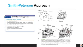 Proximal Femoral Fracture in Ped.pdf