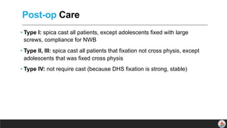 Proximal Femoral Fracture in Ped.pdf