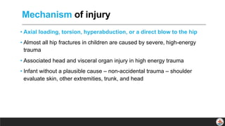 Proximal Femoral Fracture in Ped.pdf