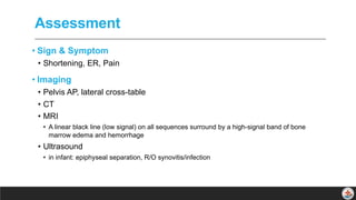 Proximal Femoral Fracture in Ped.pdf