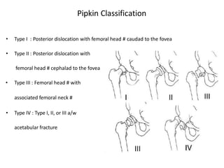 proximalfemoralfractures-190716152524.pptx