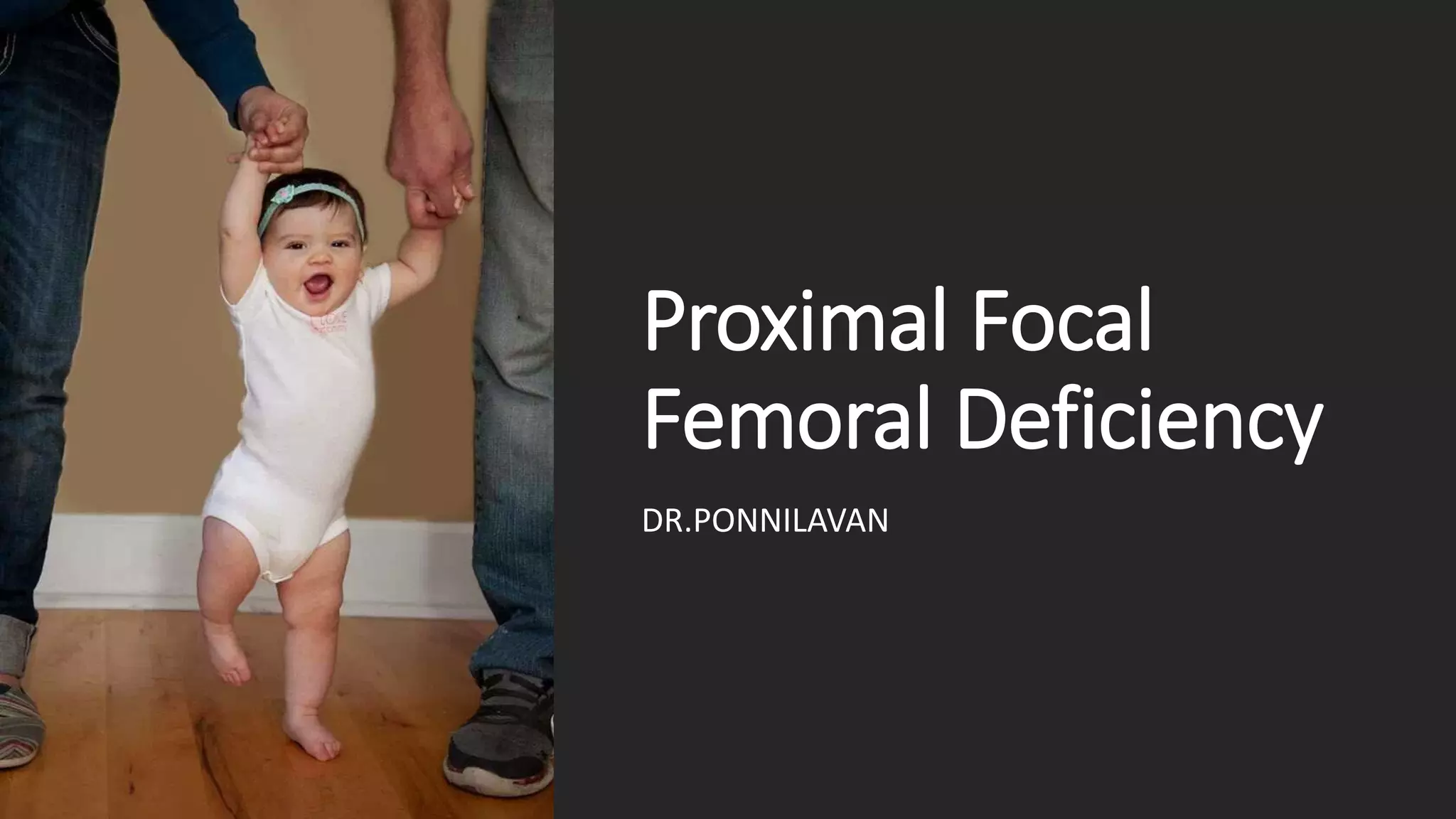 Proximal femur focal def | PPTX