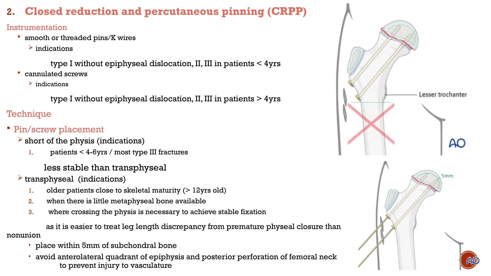 Proximal femur fracture - pediatrics.pptx