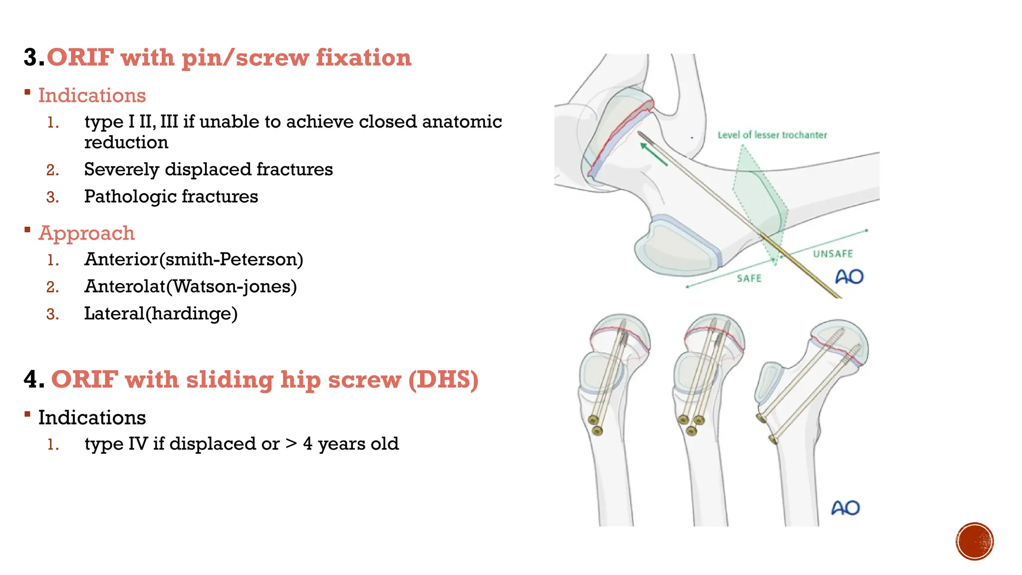 Proximal femur fracture - pediatrics.pptx