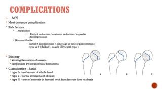 Proximal femur fracture - pediatrics.pptx