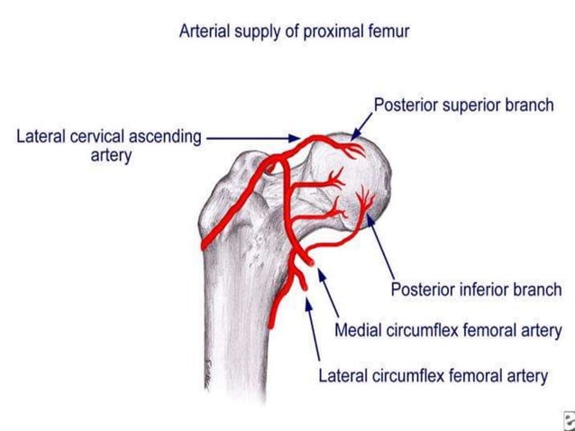 Proximal femur fracture in children | PPTX