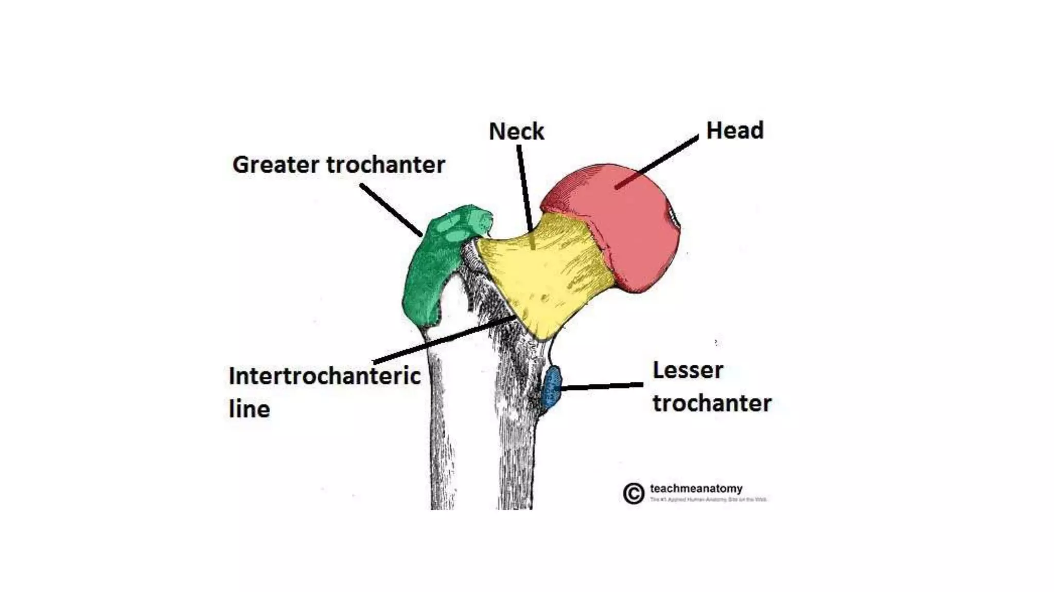 Proximal femur fractures | PPTX