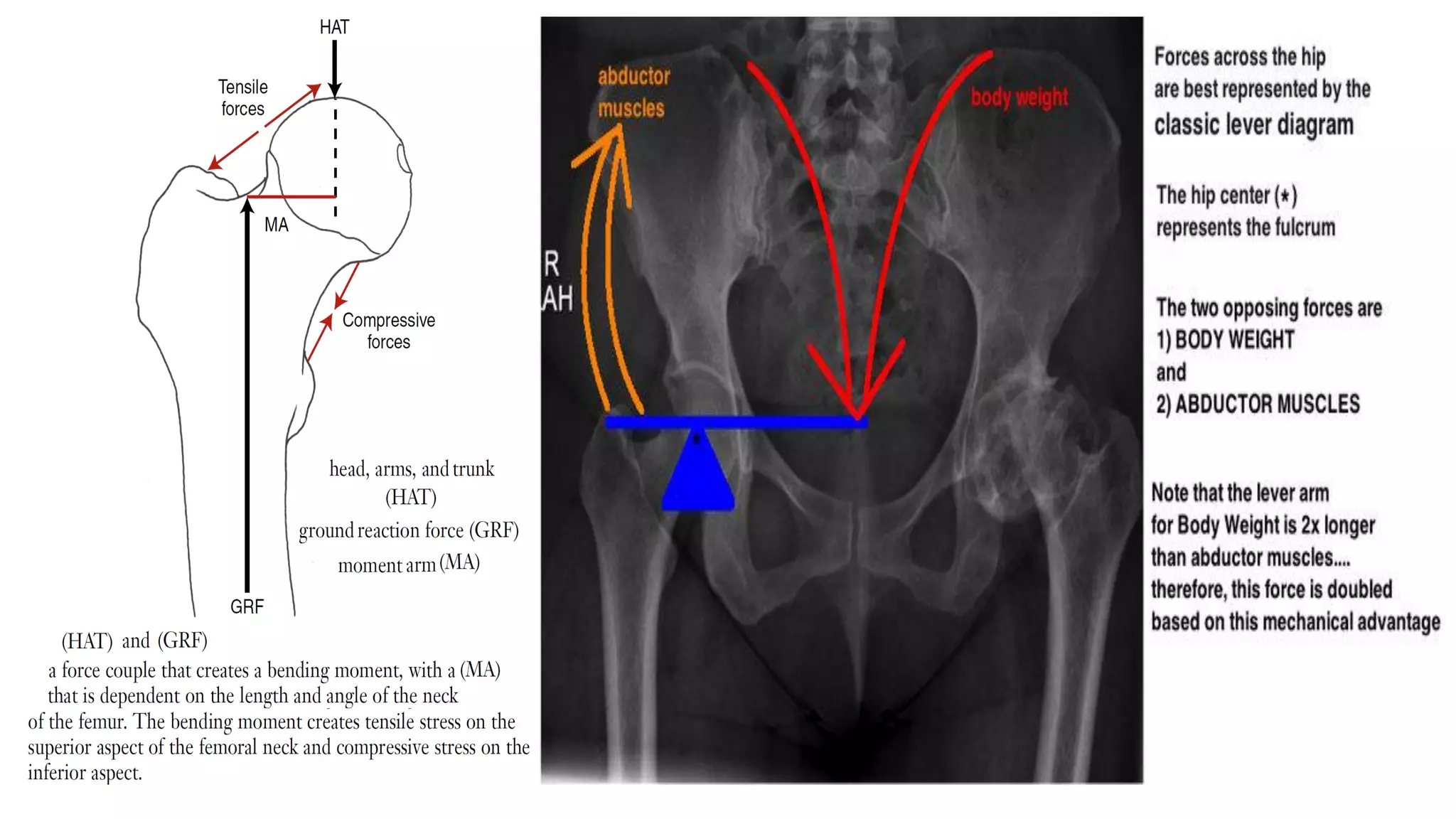 Proximal femur orthopaedic anatomy | PDF