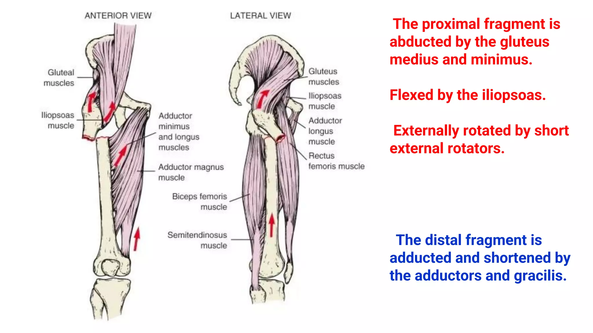Proximal femur orthopaedic anatomy | PDF