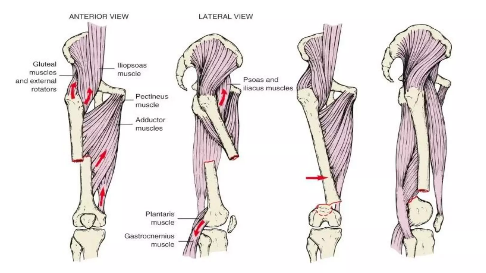 Proximal femur orthopaedic anatomy | PDF