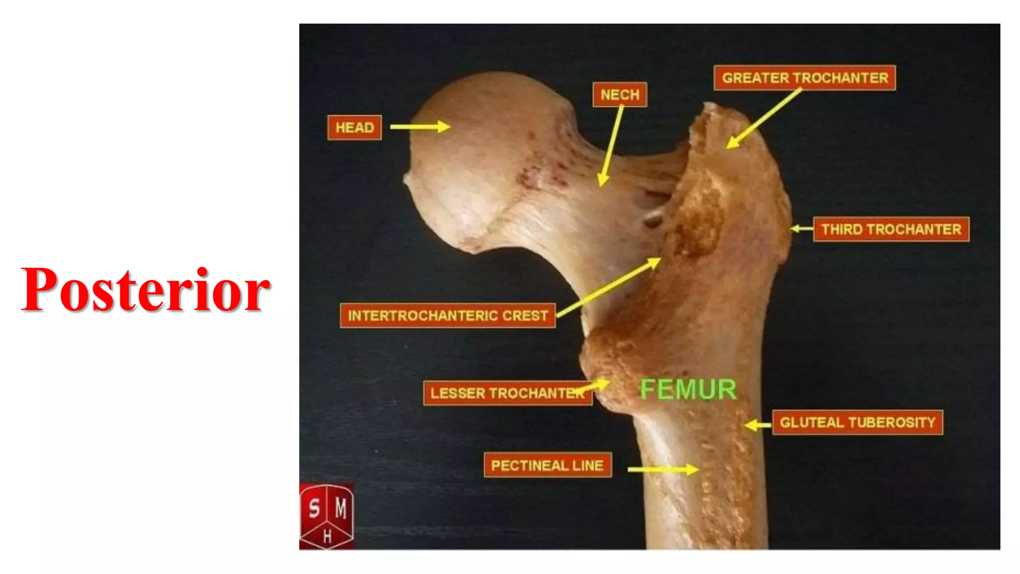 Proximal femur orthopaedic anatomy | PDF