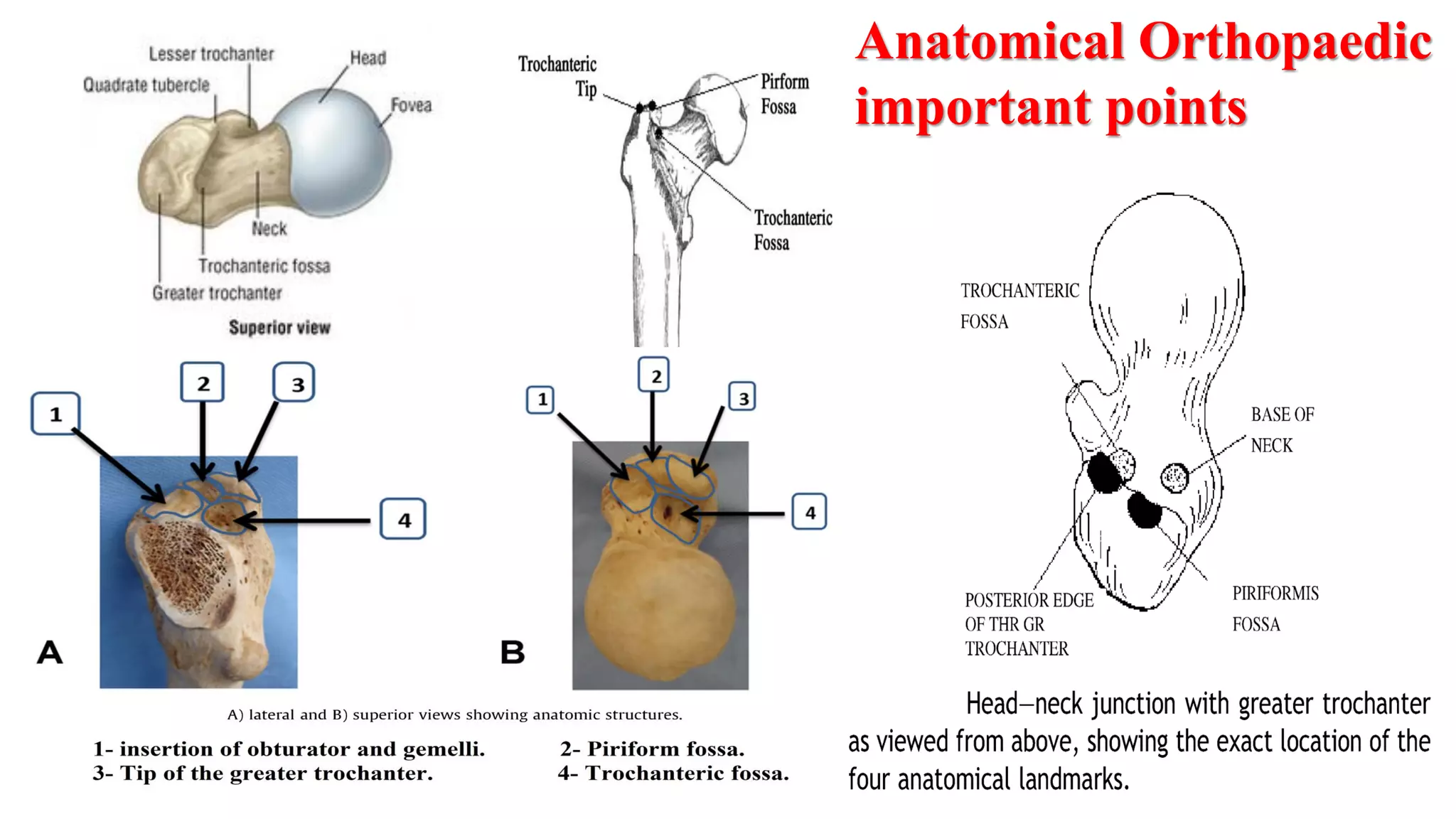 Proximal femur orthopaedic anatomy | PDF