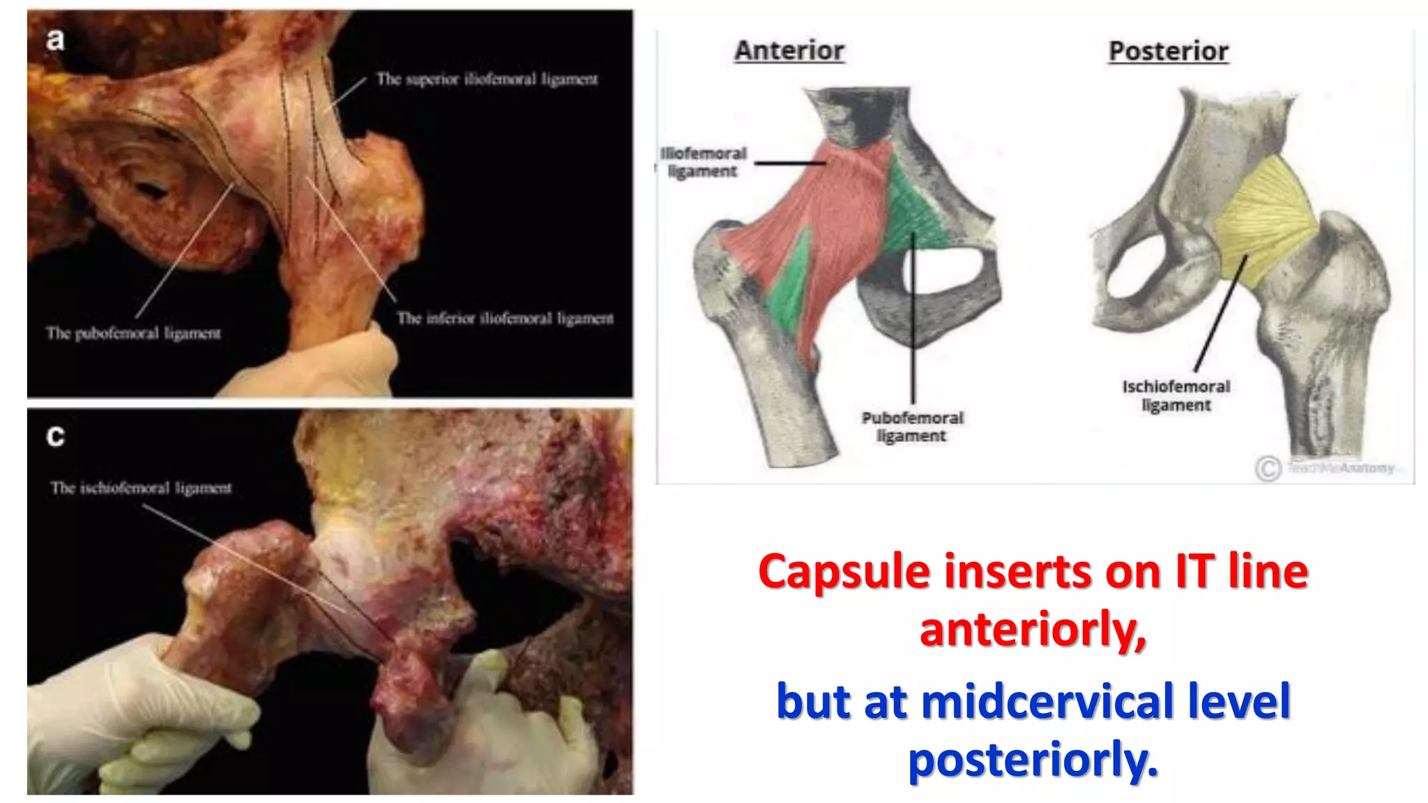 Proximal femur orthopaedic anatomy | PDF