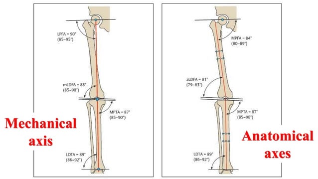 Proximal femur orthopaedic anatomy | PDF