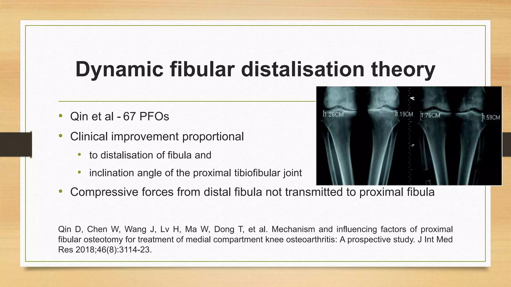 Proximal fibular osteotomy - What is the evidence? | PPTX