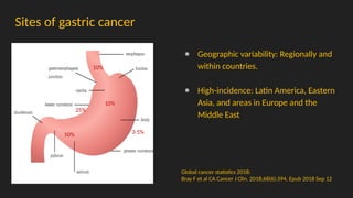 Proximal Gastrectomy With Double Tract Reconstruction.pptx
