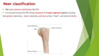 The proximal humeral fractures .pptx