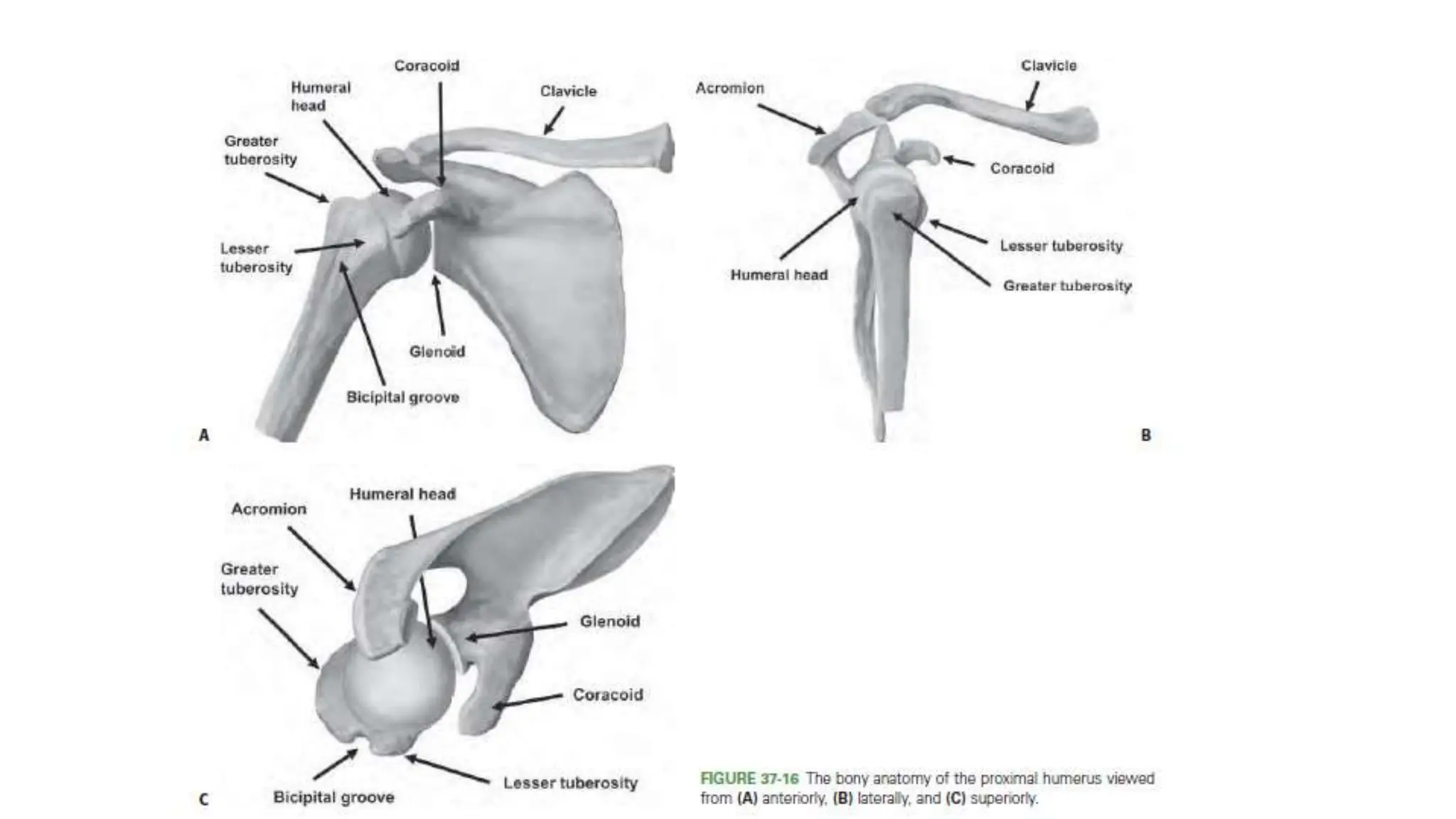 PROXIMAL HUMERUS FRACTURE TREATMENT.pptx