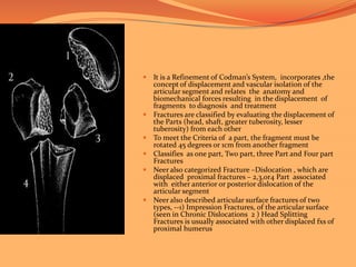 Proximal humerus fracture Management | PPTX